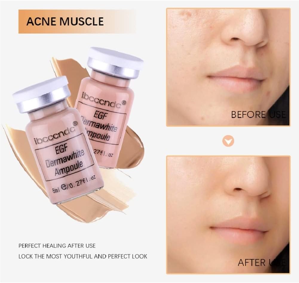 NALACAL Semi-Permanent Foundation Liquid for Microneedling System, Lon ...